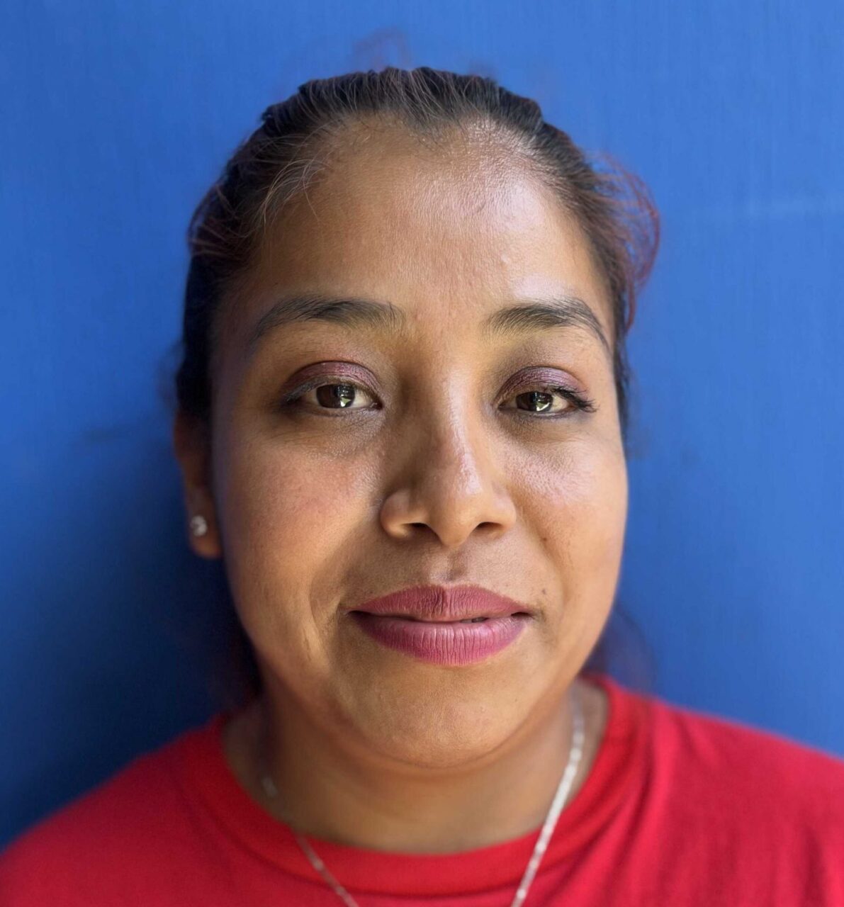 Partner for Surgery | Aleida de la Cruz